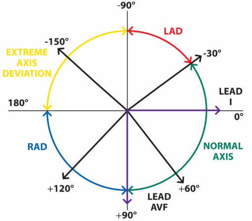 Hexaxial plus I and AVF - Medical Exam Prep