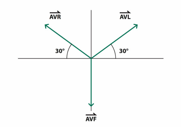 AVR AVL AVF - Medical Exam Prep