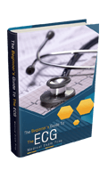ecg guide final - Medical Exam Prep