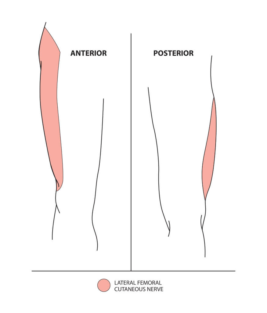 Lateral femoral cutaneous nerve - Medical Exam Prep